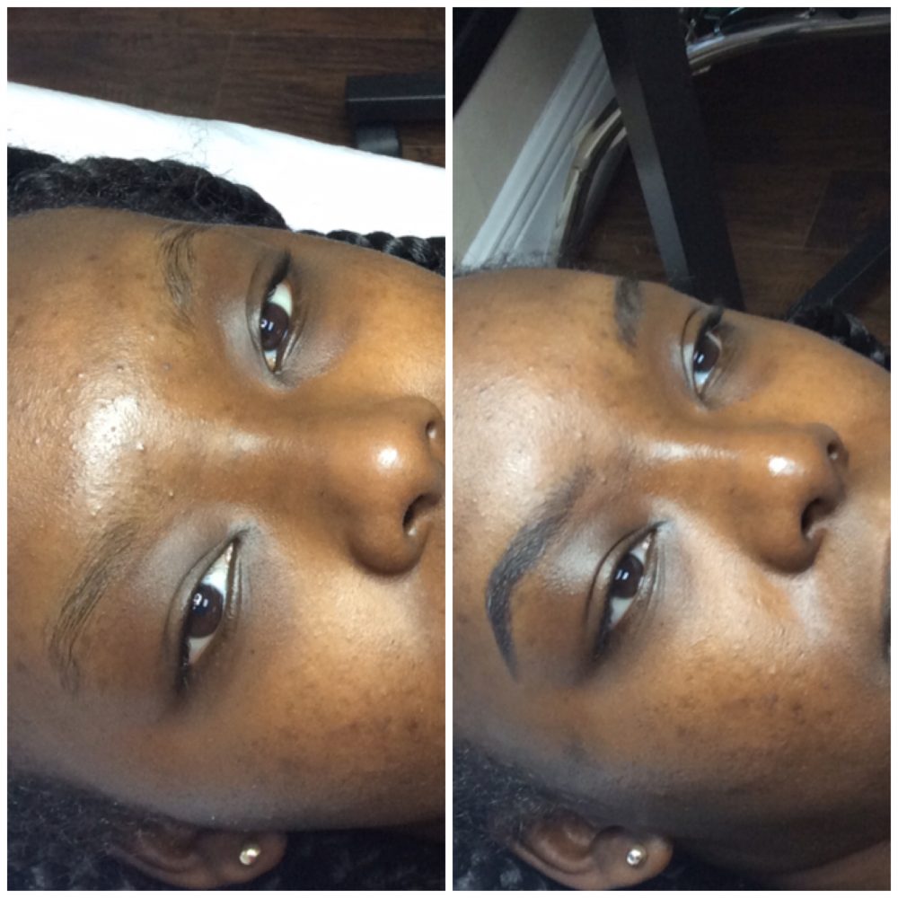 Permanent Makeup Before & After photos